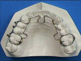 Rideau Orthodontic Mfg. Ltd. & Bonarch Supply Canada Ltd.